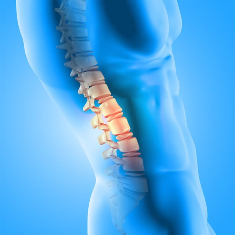 1 Best Posture Correction In Kuala Lumpur Malaysia